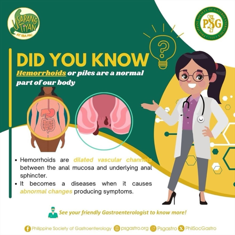 What are Hemorrhoids? - Philippines Society of Gastroenterology
