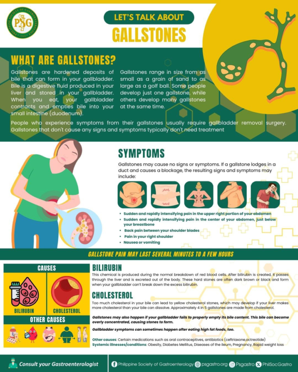 What is Gallstones? - Philippines Society of Gastroenterology
