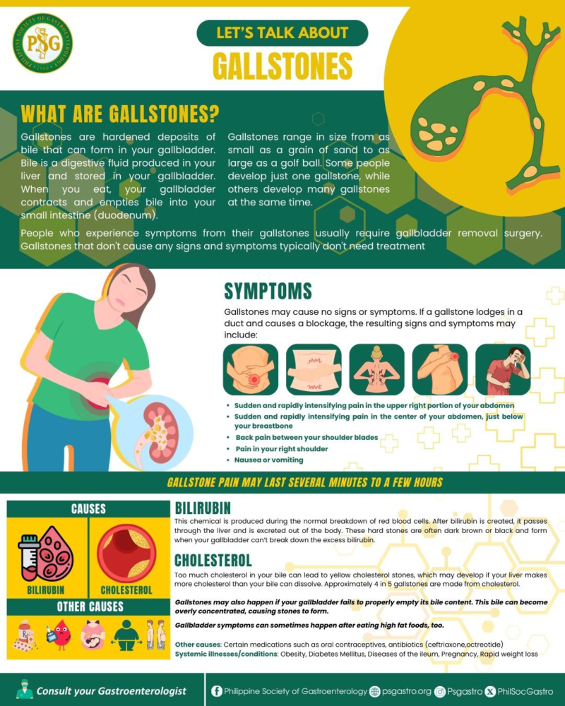 What is Gallstones? - Philippines Society of Gastroenterology